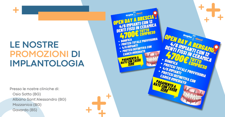 Le nostre PROMO DI IMPLANTOLOGIA… trattamento arcata fissa | impla-dent.it